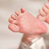 Osteopenia of prematurity – The Baby Specialist